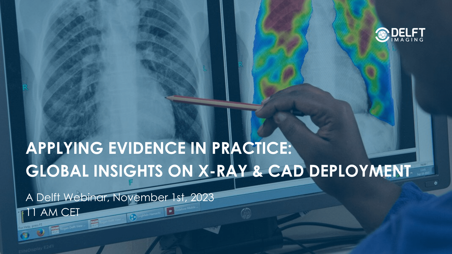 Global Insights on X-rays and CAD Deployment