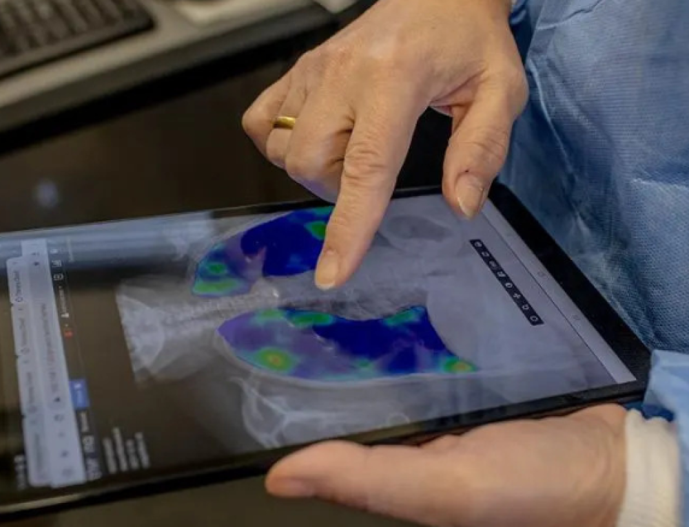 Kenya - Integration of CAD4TB & National TB Data System (TIBULIMS) - Delft Imaging